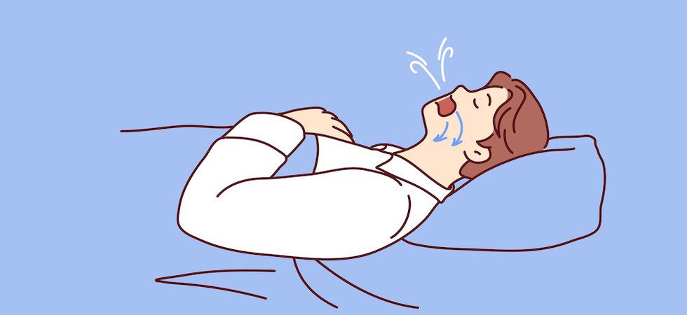 AcuPebble sleep apnoea device trial underway at University of Warwick ...